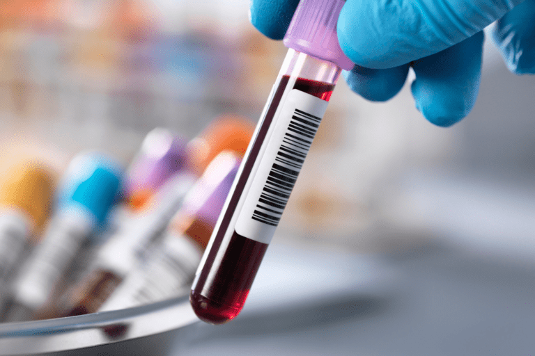 Chronic Kidney Disease 101: Lab Tests, Values Explained - Avoid ...