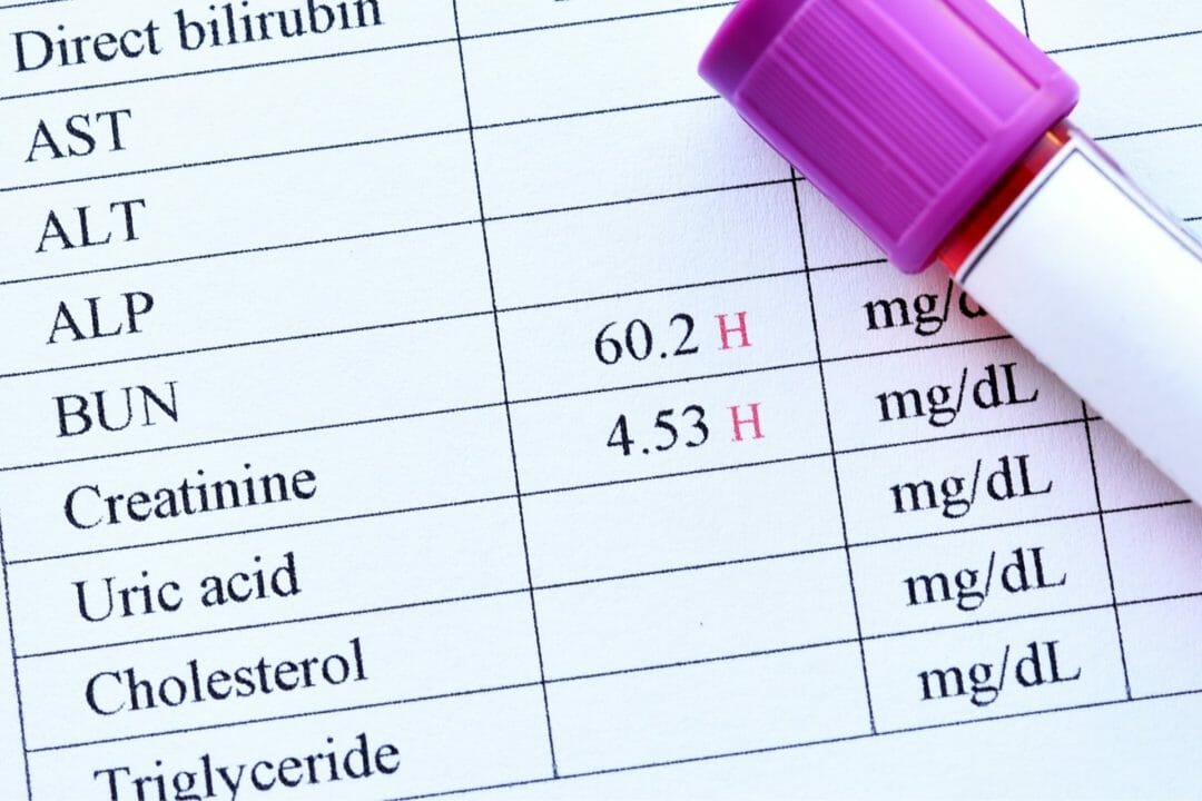 What is Blood Urea Nitrogen (BUN)? - Avoid dialysis through diet and ...