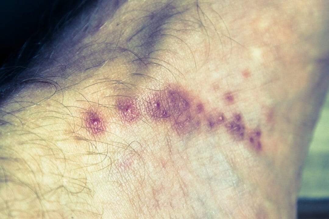 do kidney problems cause skin problems