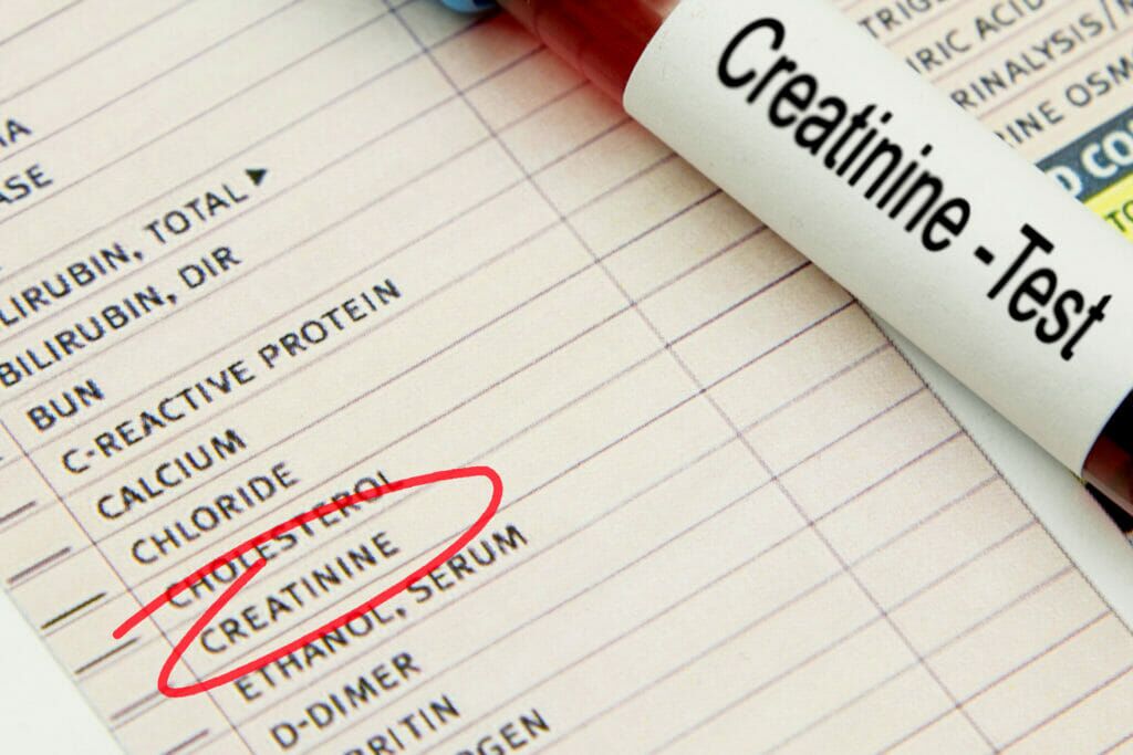 Unraveling the Truth: Does Fish Oil Contain Creatine? - Avoid dialysis ...